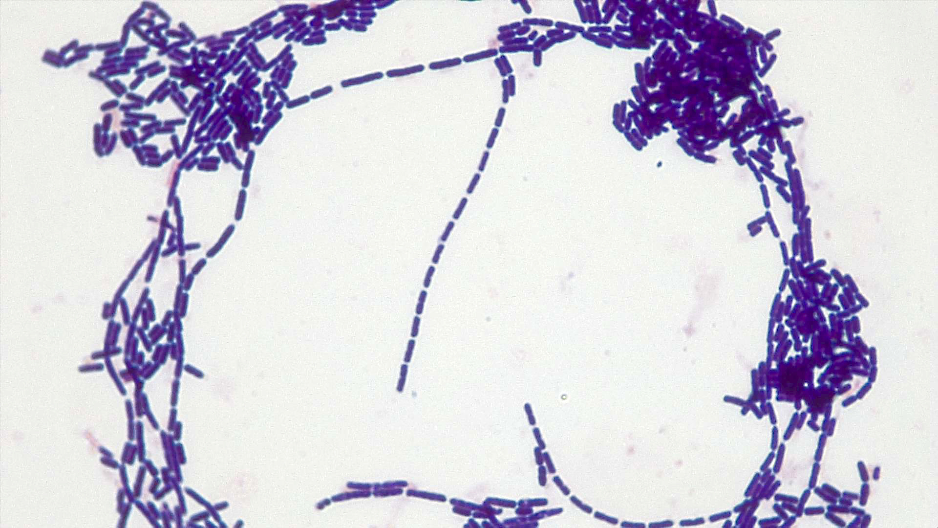 Micrograph Bacillus Subtilis Gram Stain 1000x P000010 OER Commons Micrograph Bacillus Subtilis Gram Stain 1000x P000010 OER Commons