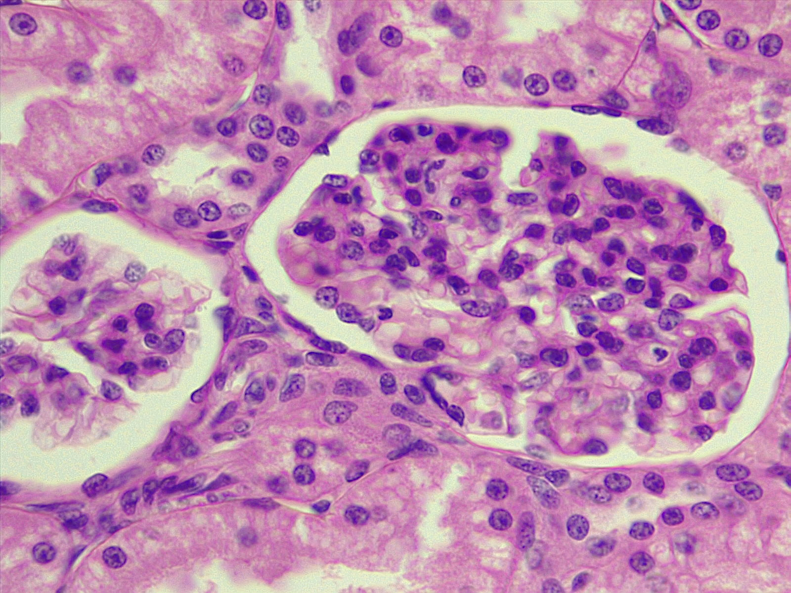 Simple Squamous Epi kidney bowmans Capsule 630x P000123 OER Commons