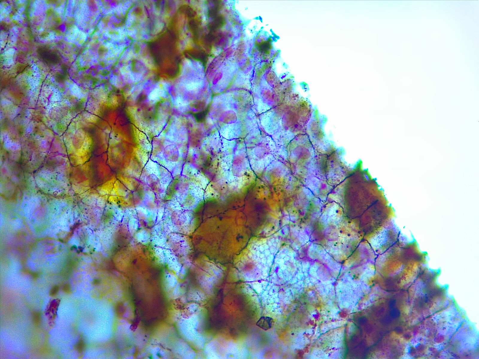 simple squamous epi_top view_wide mount_mesothelium_400x, p000126 | OER ...
