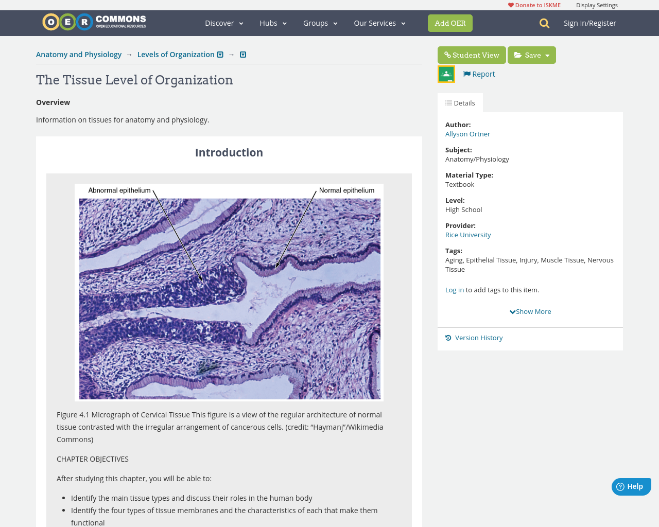Anatomy and Physiology, Levels of Organization, The Tissue Level of ...