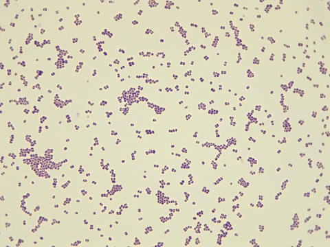 Micrograph Coccus Gram stain 1000x p000031 | OER Commons