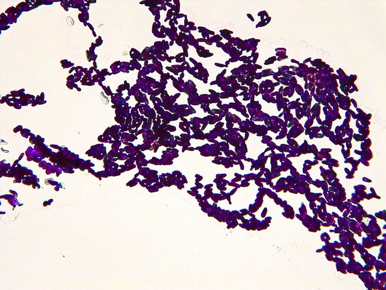 Micrograph Candida albicans Gram stain 400x p000022 | OER Commons