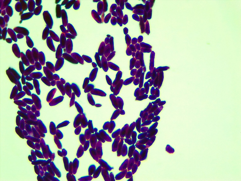 Micrograph Candida albicans Gram stain 1000x p000025 | OER Commons