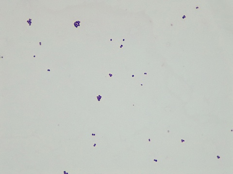Micrograph Micrococcus luteus Gram stain 1000x p000026 | OER Commons